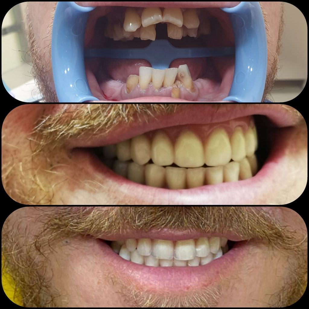 Casos clínicos - Clínicas Dentales Doctor Castillo